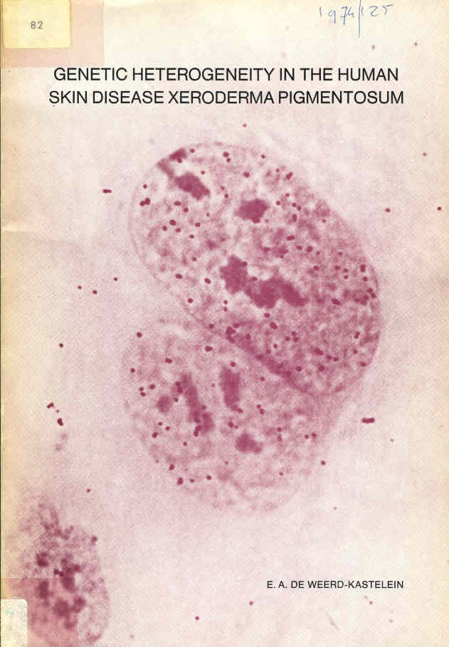 Xeroderma Pigmentosum Xp Xeroderma Skin Diseases Skin Conditions